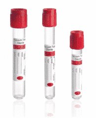 Choosing the Right Test Tube - Buying Guides MedicalExpo
